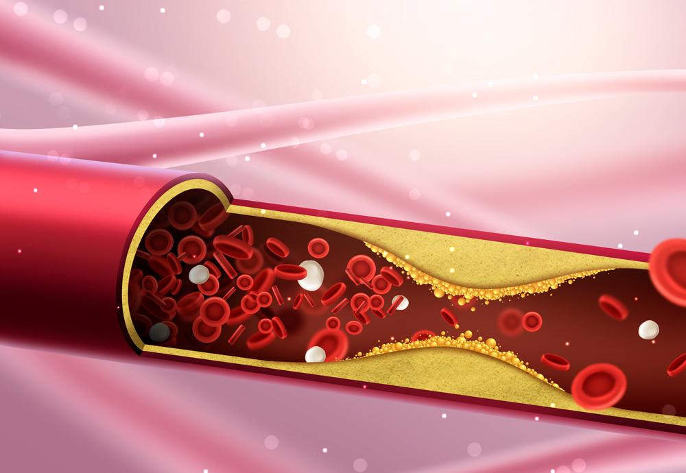 Superfood that prevents 'silent disease' hyperlipidemia? – Archyde